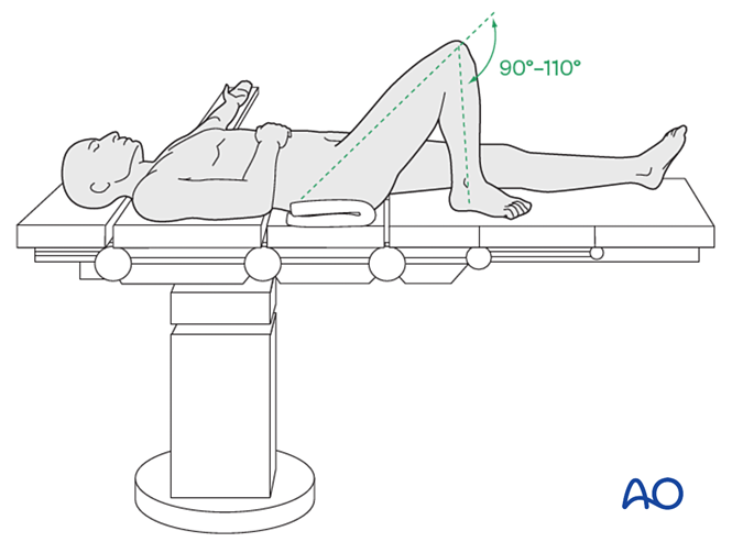 Flexed knee position for intramedullary nailing