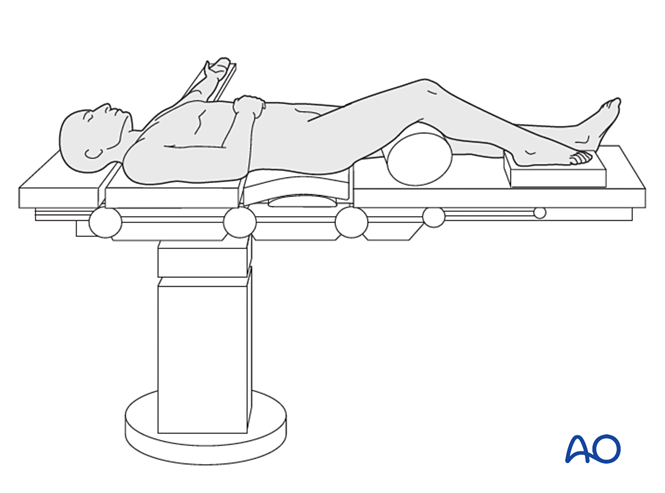 Semi-extended knee position for intramedullary nailing