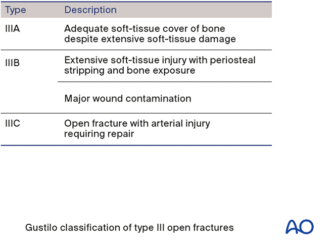 Principles of management of open fractures