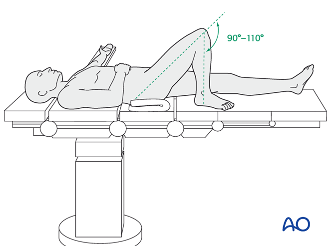 Supine position for nailing