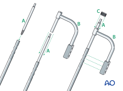 Nailing without image intensification