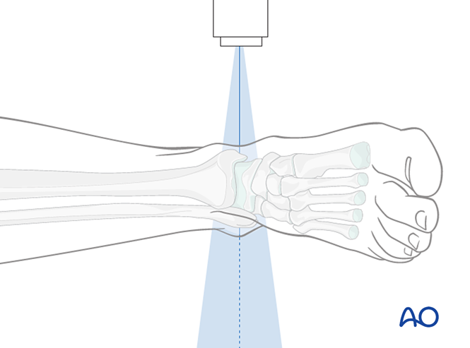 Intraoperative imaging of the ankle