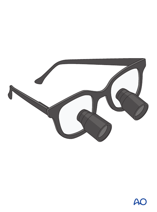 Anterior C2–C3 fusion for Region III Type B: Nondisplaced ligamentous ...