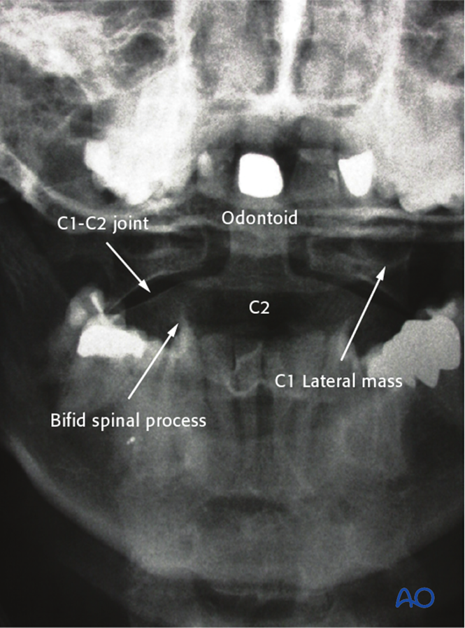 Patient examination: radiological evaluation (XR, CT, MRI)