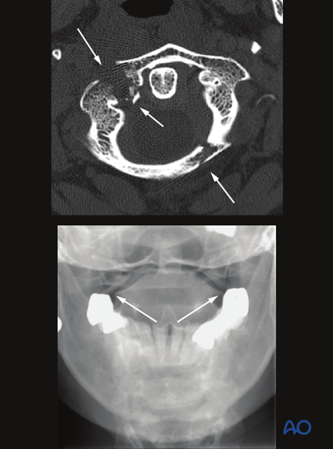 Patient examination: radiological evaluation (XR, CT, MRI)