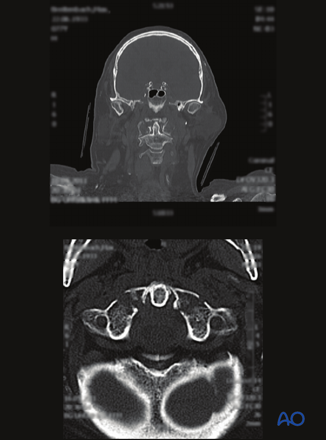 Patient examination: radiological evaluation (XR, CT, MRI)