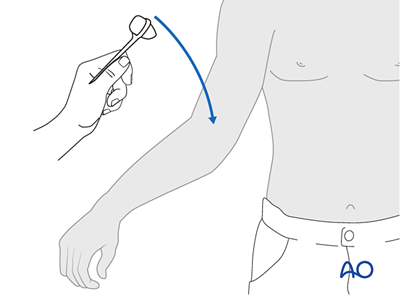 Patient examination: Neurological evaluation