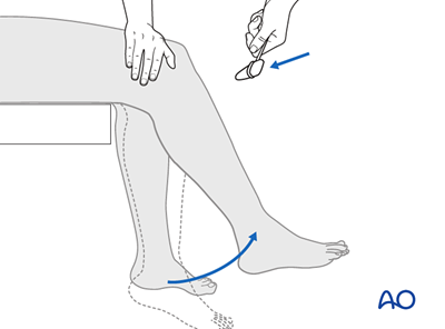 Patient examination: neurological evaluation