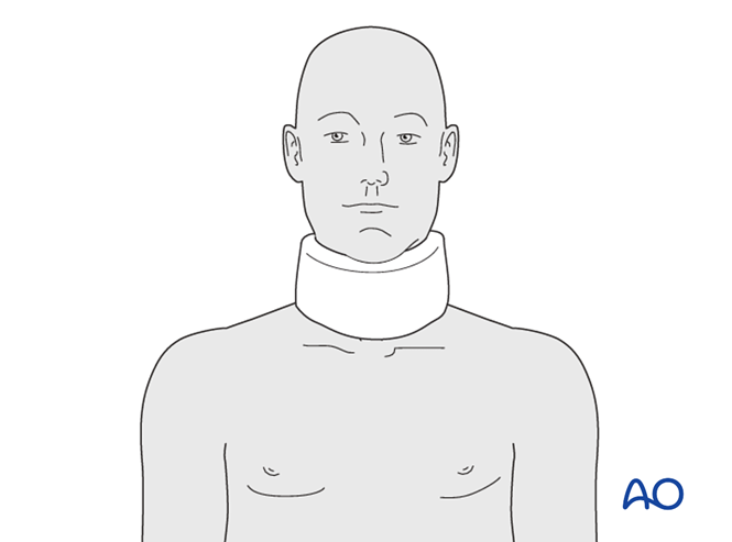 Nonoperative (collars) for A1 Compression fracture single endplate