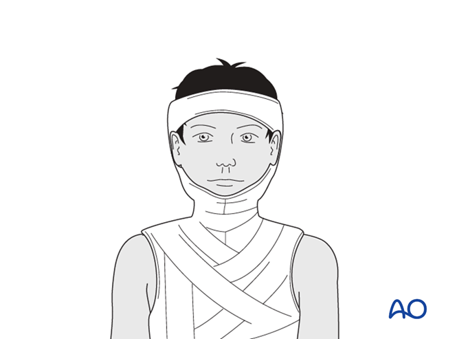 Nonoperative (collars) for A0 - Minor, nonstructural fractures