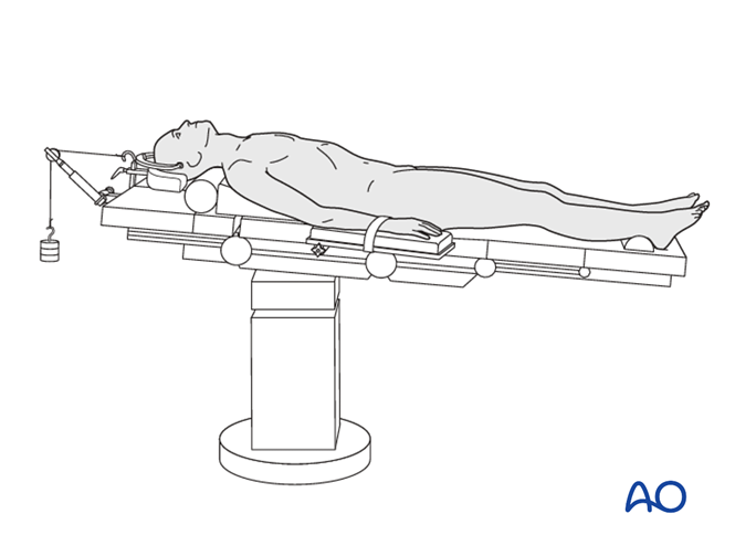 Supine position for cervical spine surgery