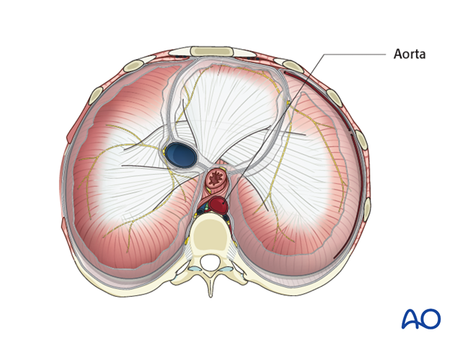 Minimally invasive right sided thoracic approach (T4-T10)