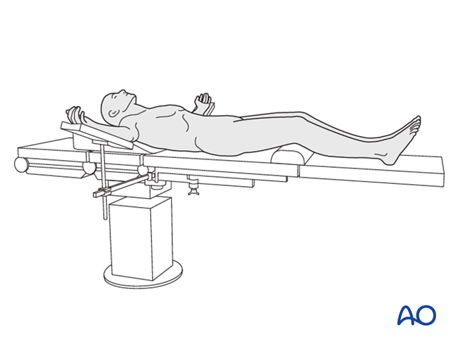 Supine position for mini open retroperitoneal approach (L4-S1)