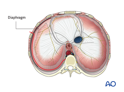 Anterior approach to the lumbar spine