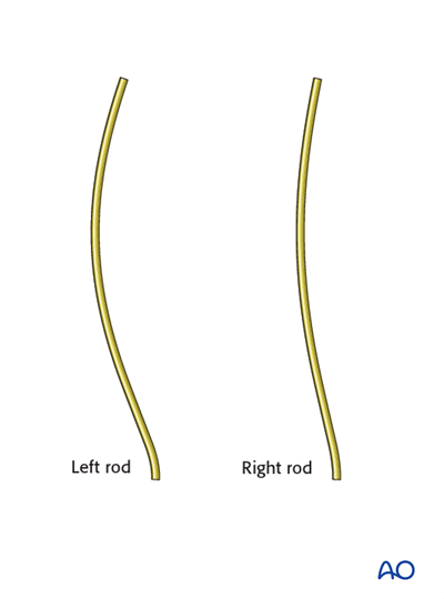 Posterior Screws - With direct vertebral body derotation for Lenke 1