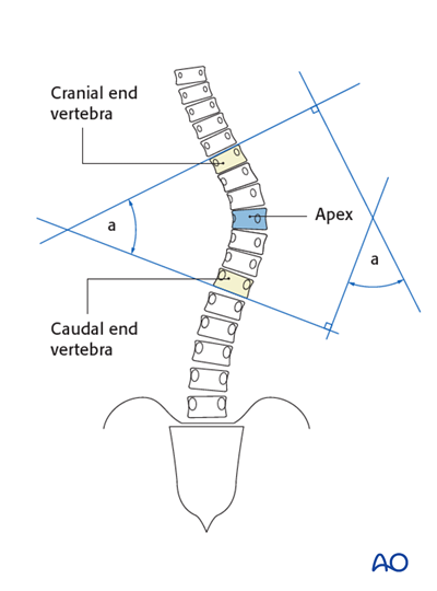 Patient examination