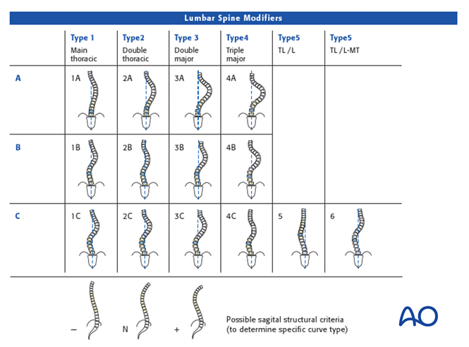 Lenke classification