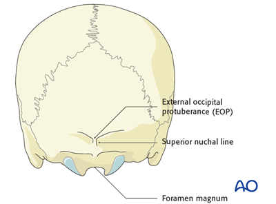 Posterior access to the occipitocervical spine