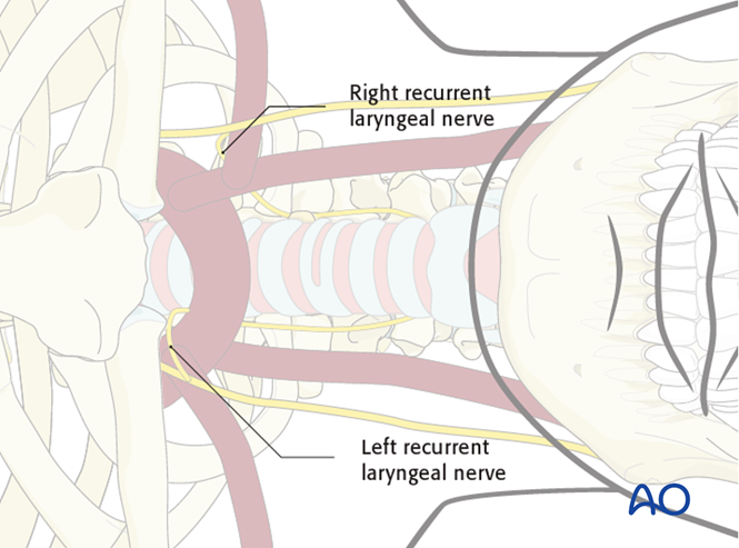 Anterior access to the cervical spine (C3–C7)