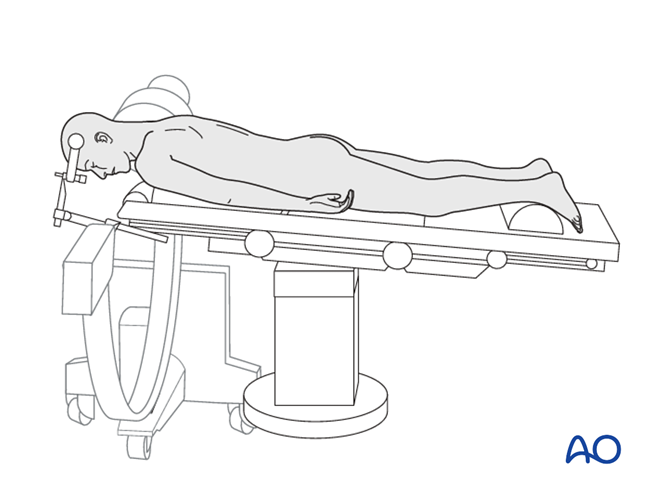 Prone position for approaches to C0–C7