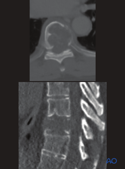 Evaluation of stability