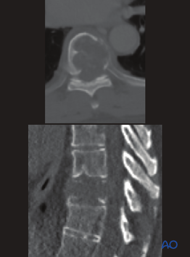Evaluation of stability