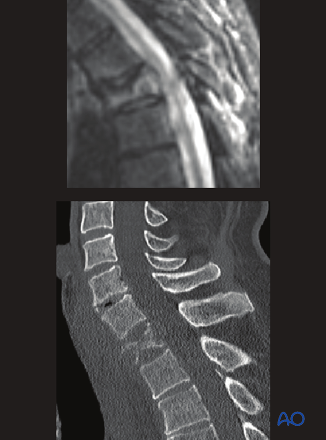 Evaluation of stability
