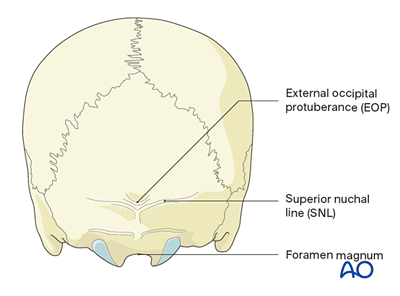 Posterior access to the occipitocervical spine (C0–C2)