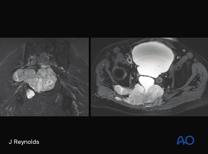 Malignant tumors C1 to C7