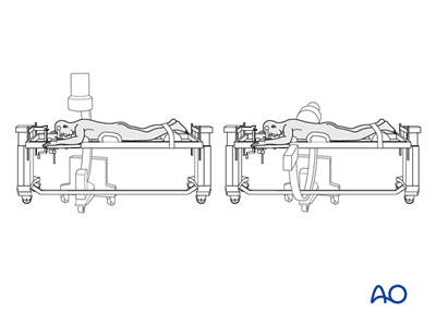 Prone position for approaches to T1–S5