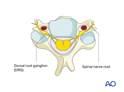 Ligation of nerves