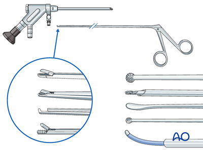 Lumbar endoscopic unilateral laminotomy for bilateral decompression (LE ...