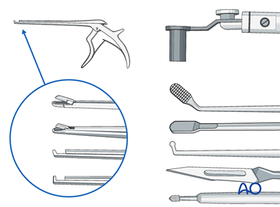 MISS Transforaminal lumbar interbody fusion (TLIF) for Lumbar spinal ...