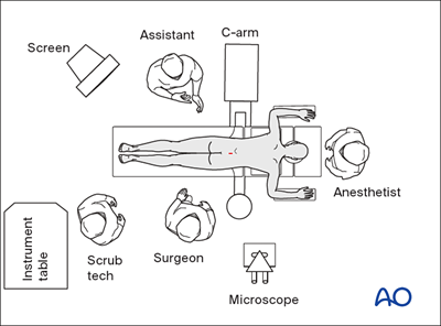 Microscopic tubular unilateral laminotomy for bilateral decompression ...