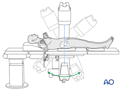 External fixation for Acute pelvic treatment