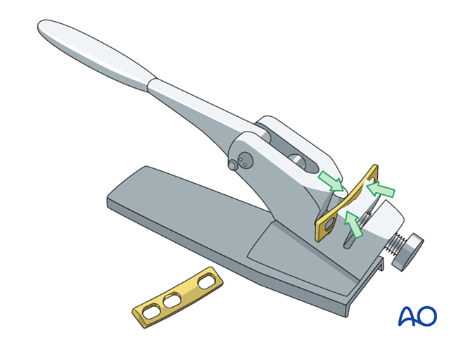 ORIF - Anterior fixation SI Joint for SI-joint fractures