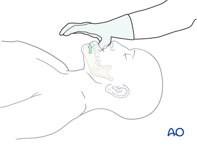 Airway for Primary survey