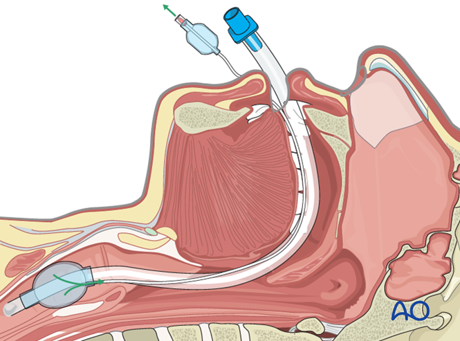 Prone position for approaches to C0–C7