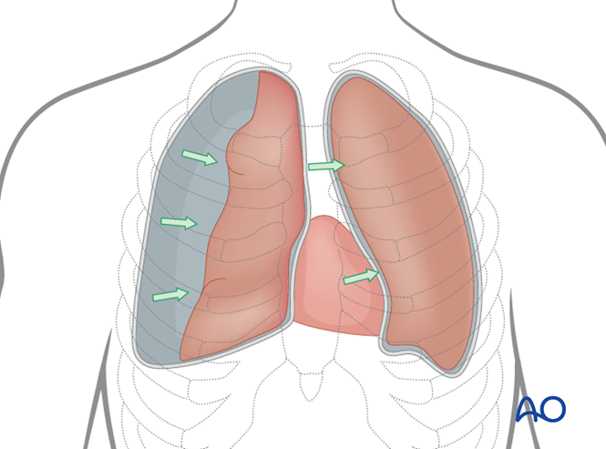 Breathing for Primary survey