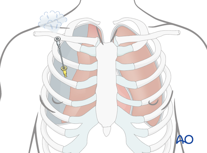 Breathing for Primary survey