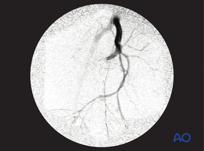 Circulation for Primary survey