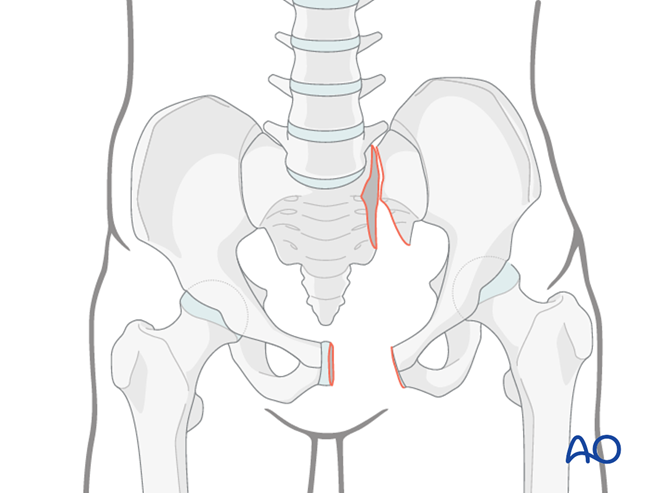 Circulation for Primary survey