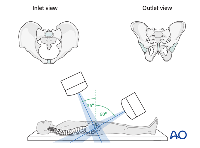 Secondary survey for