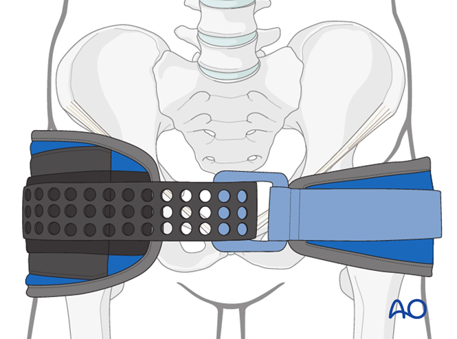 Nonoperative for Pubic ramus fractures
