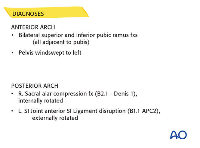 Operative treatment for Incomplete disruption of posterior arch ...
