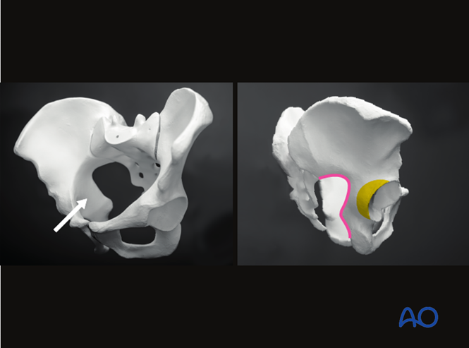 Radiology of the intact acetabulum