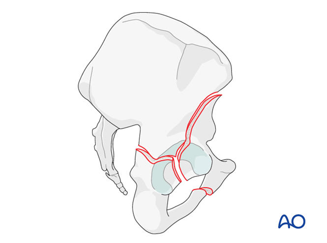 Characteristics of associated fracture types