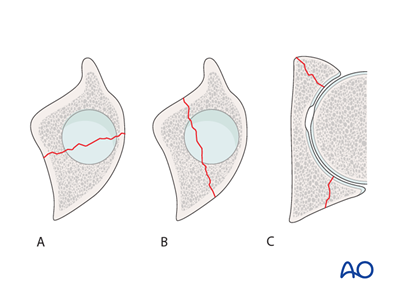 Patient assessment and diagnosis
