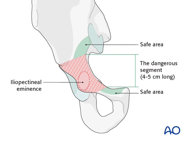 General stabilization principles and screw directions