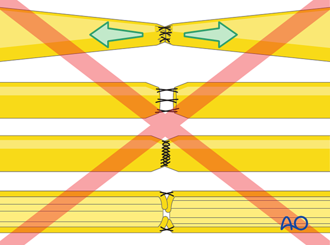 Ulnar and median nerve lesions